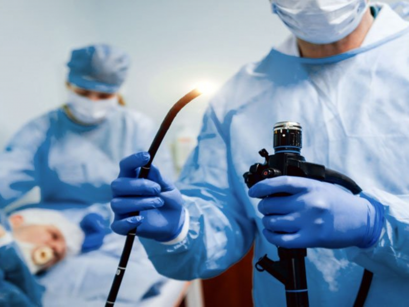 O que é Colonoscopia | Dr. Bartolomeu Basilio